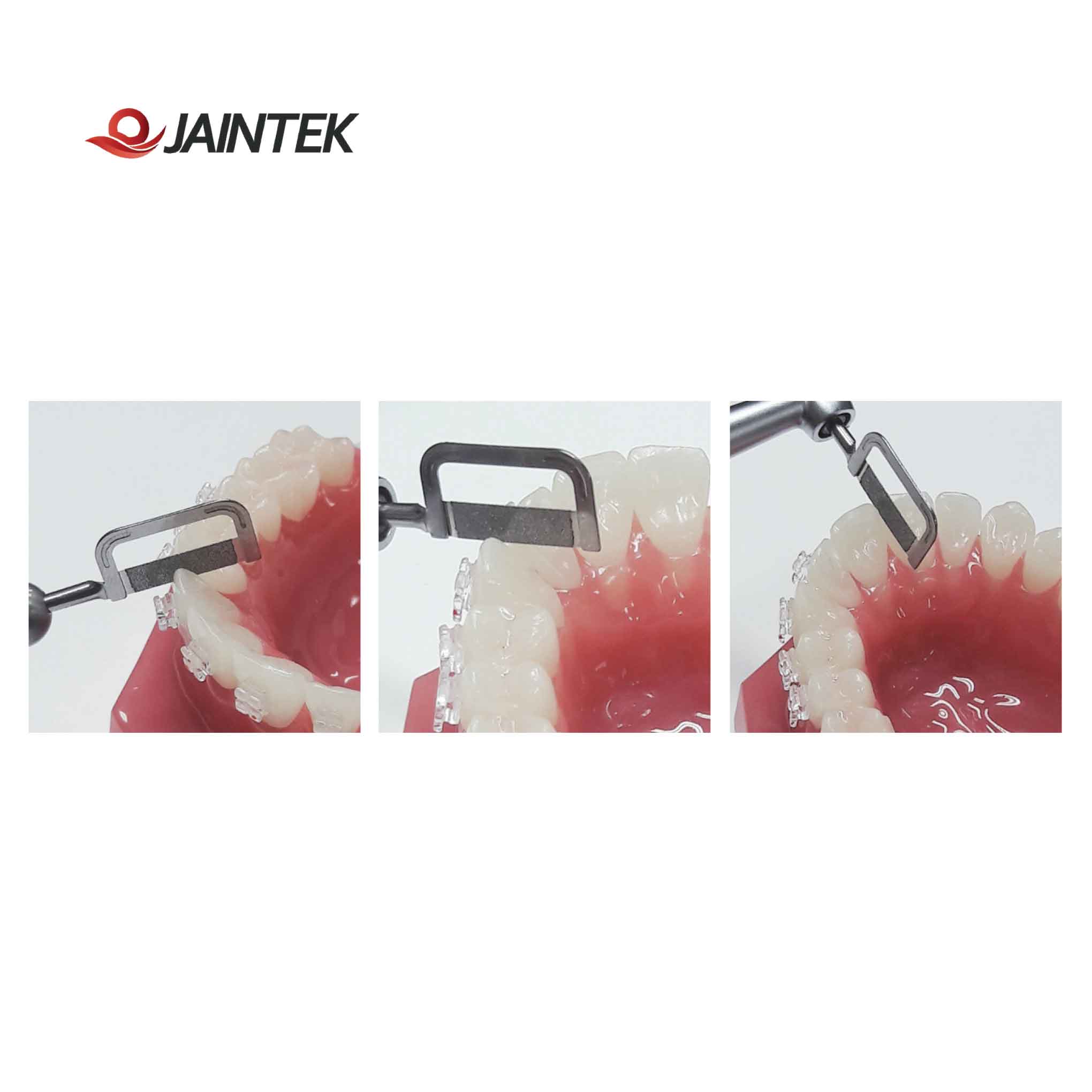 IPR Strips – Minimax Implant